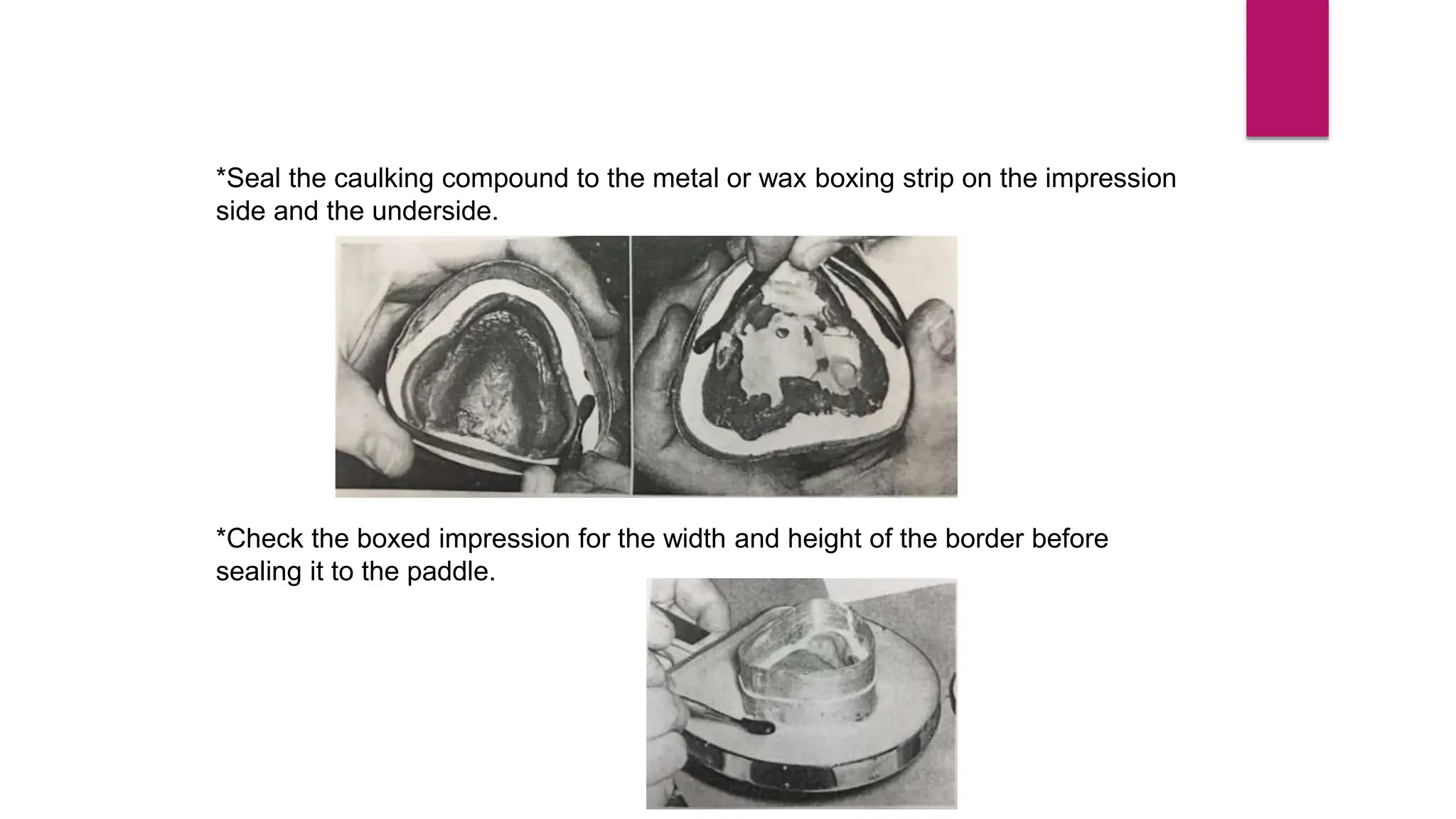 BEADING AND BOXING.ppt bds 1st year dental material | PPSX