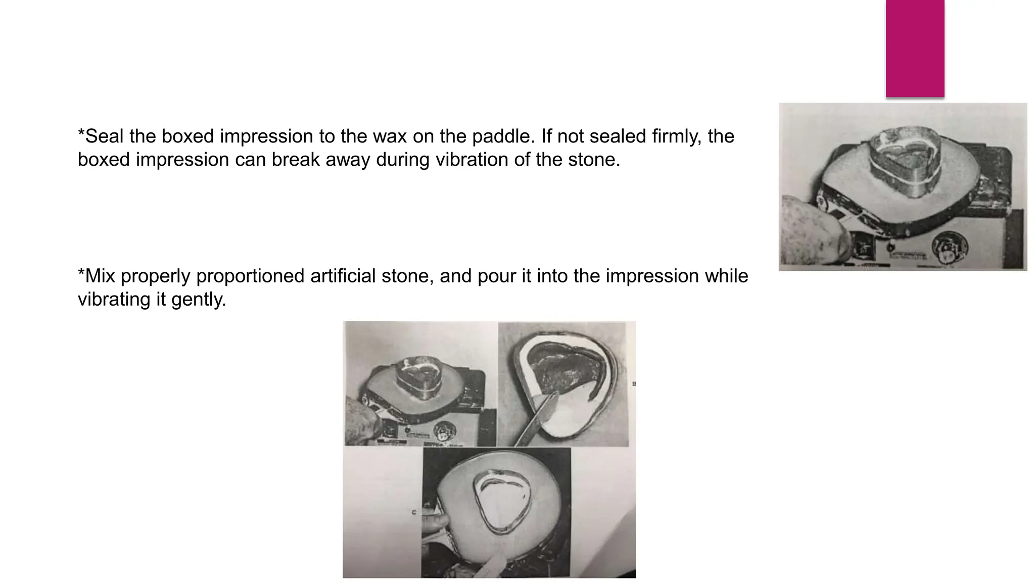 BEADING AND BOXING.ppt bds 1st year dental material | PPSX