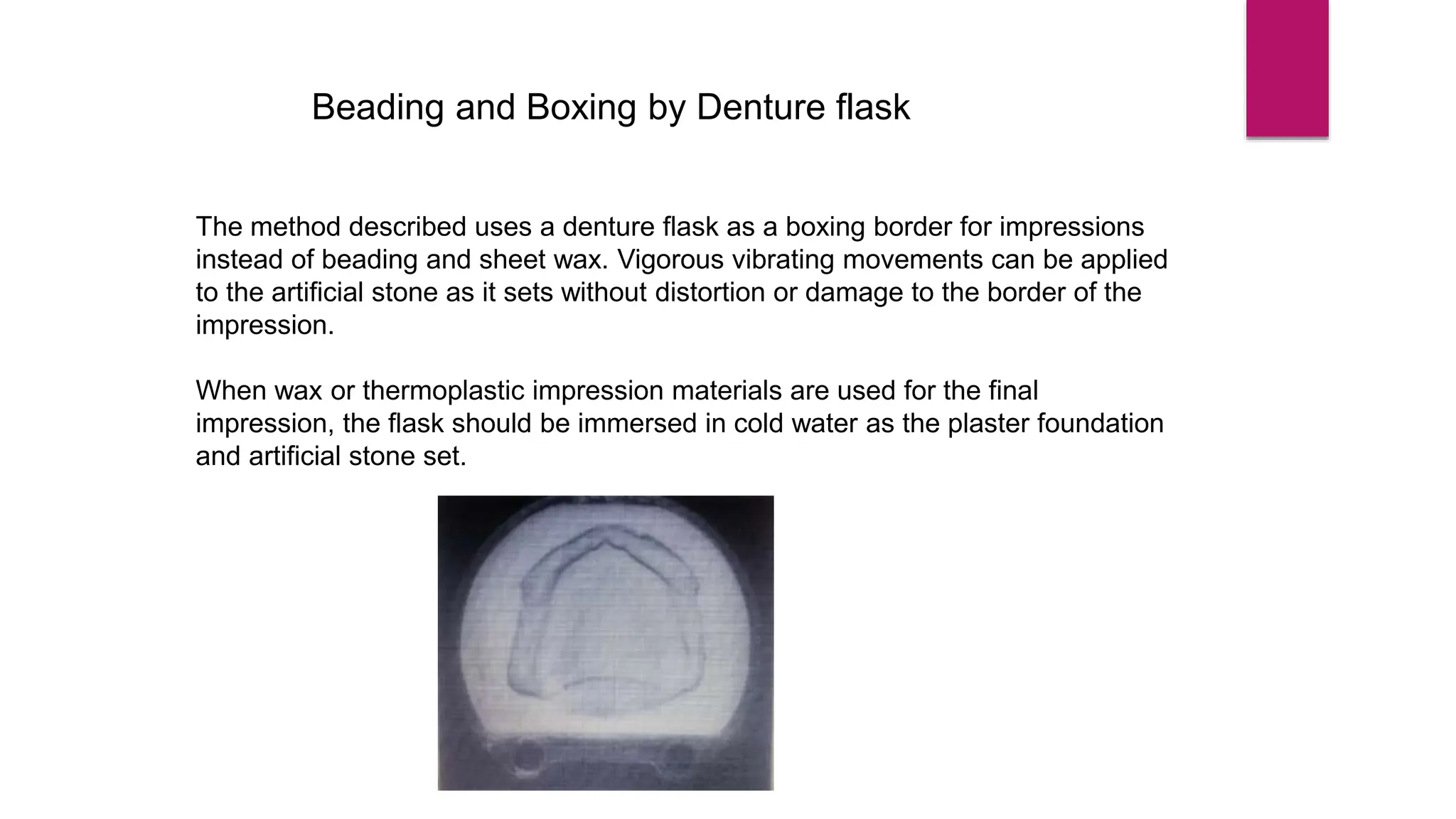 BEADING AND BOXING.ppt bds 1st year dental material | PPSX
