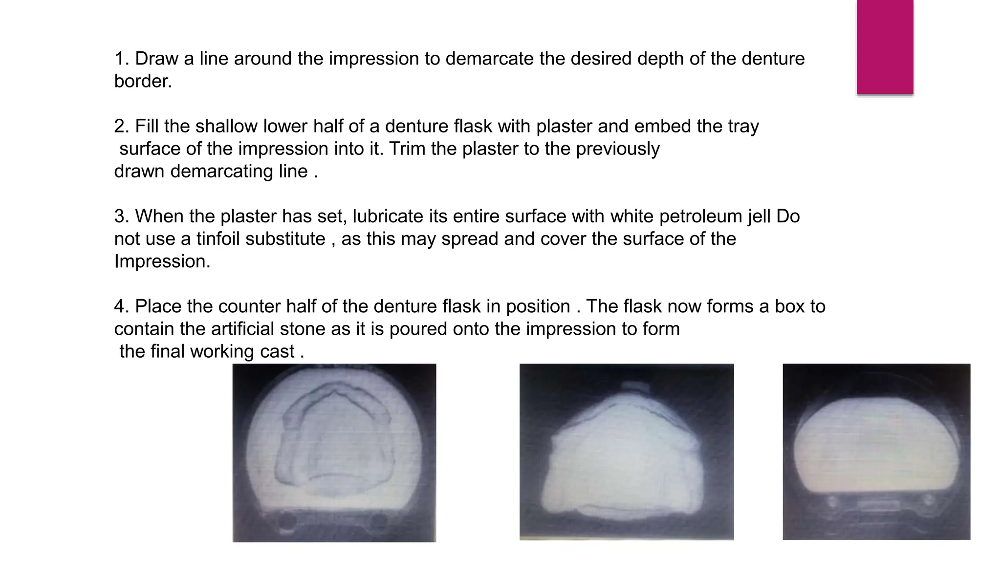 BEADING AND BOXING.ppt bds 1st year dental material | PPSX