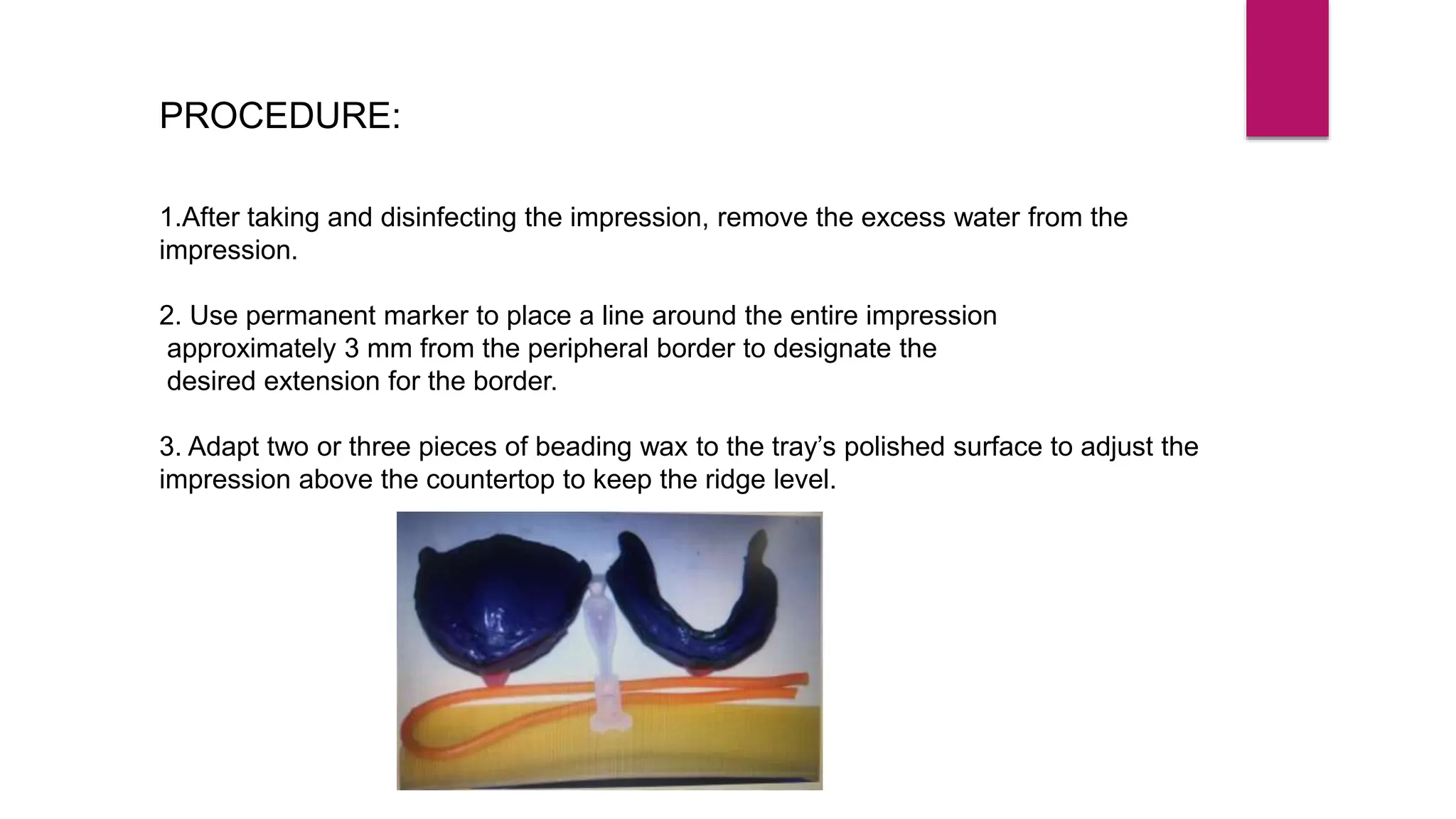 BEADING AND BOXING.ppt bds 1st year dental material | PPSX