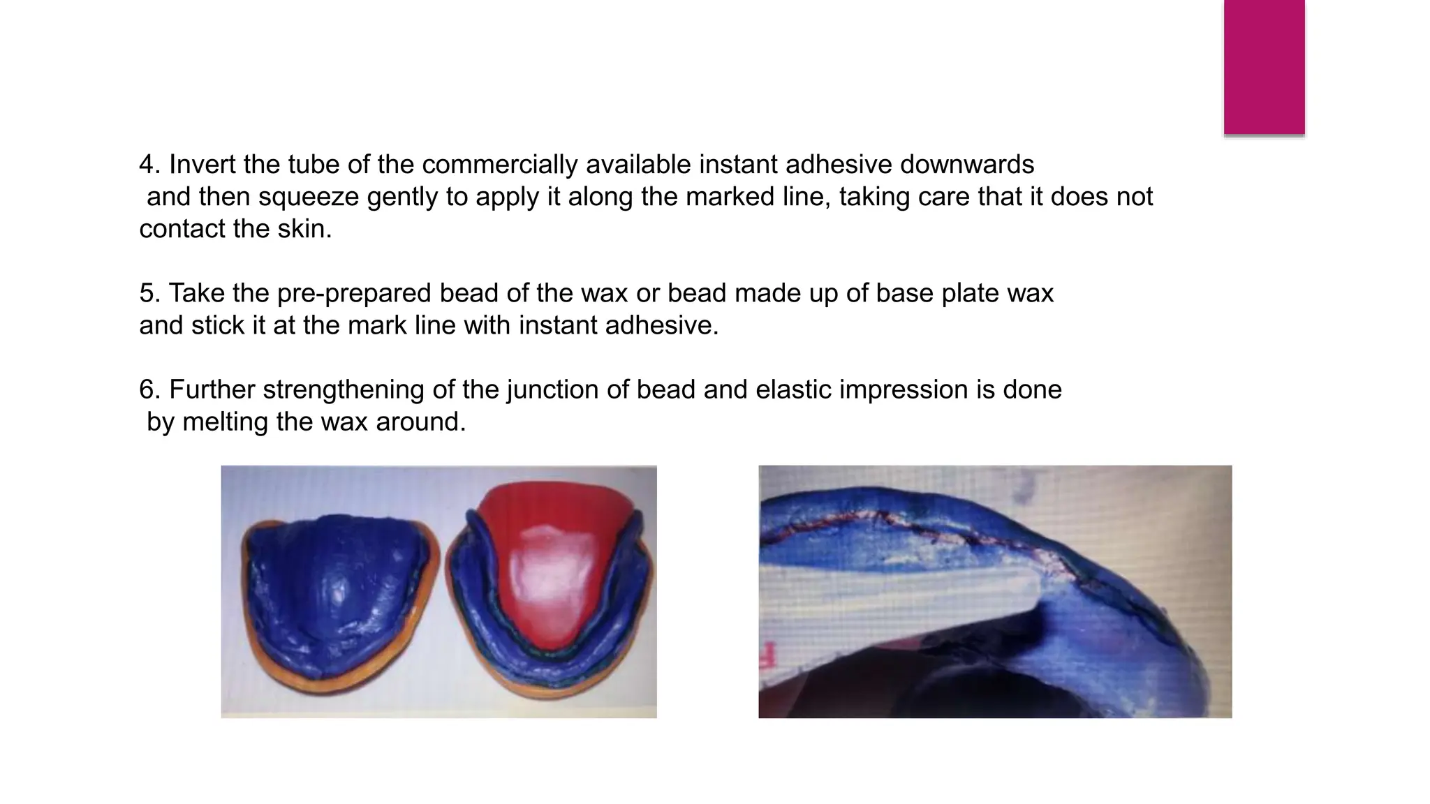 BEADING AND BOXING.ppt bds 1st year dental material | PPSX