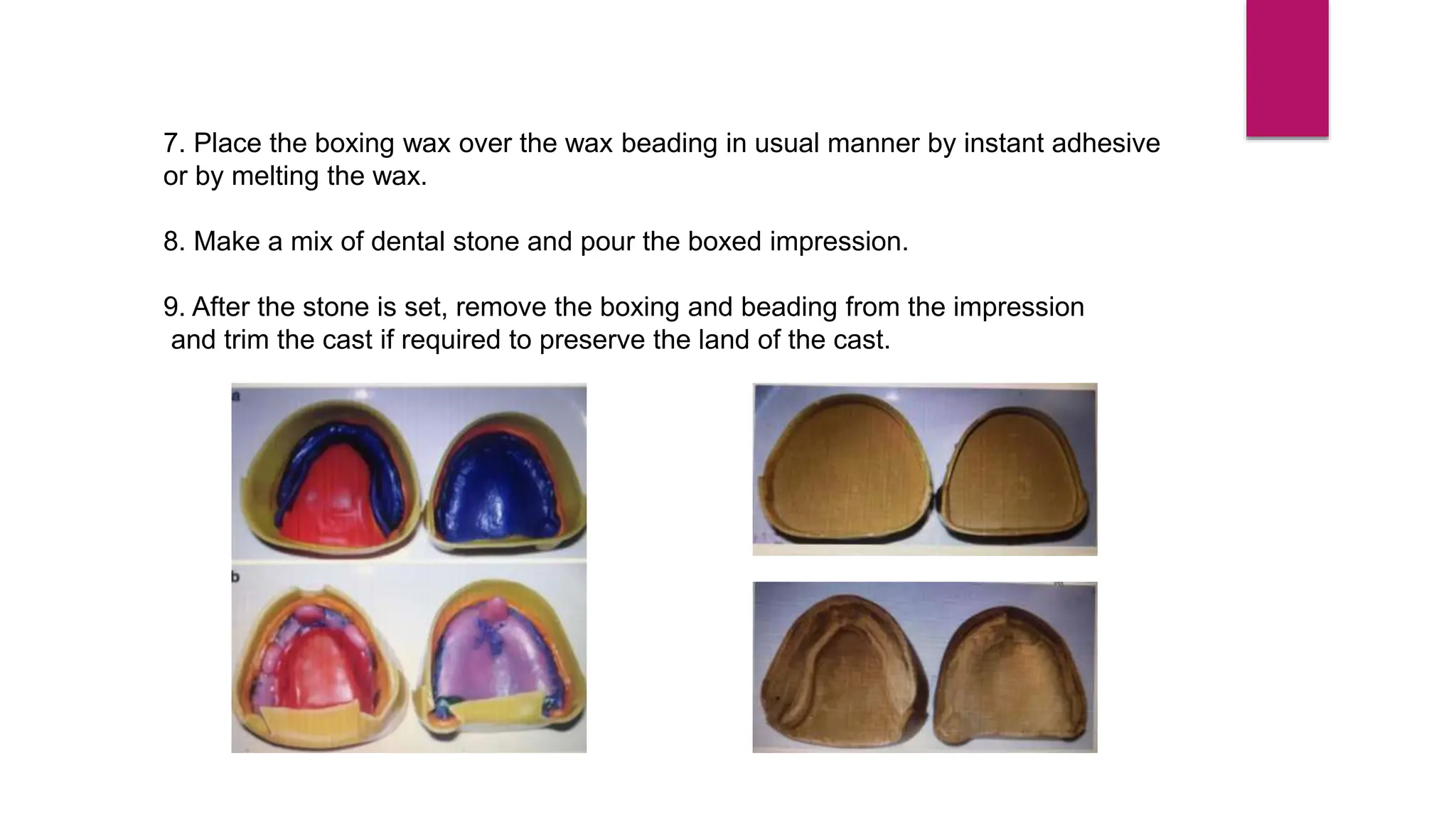 BEADING AND BOXING.ppt bds 1st year dental material | PPSX