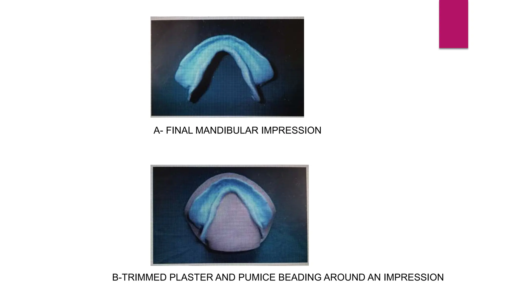 BEADING AND BOXING.ppt bds 1st year dental material | PPSX