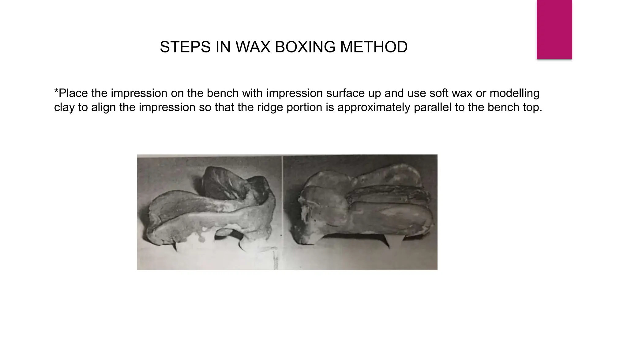 BEADING AND BOXING.ppt bds 1st year dental material | PPSX