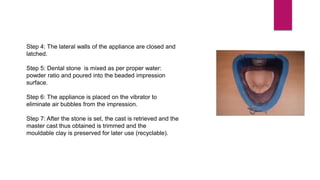 BEADING AND BOXING.ppt bds 1st year dental material | PPSX