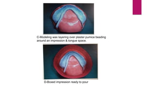 BEADING AND BOXING.ppt bds 1st year dental material | PPSX