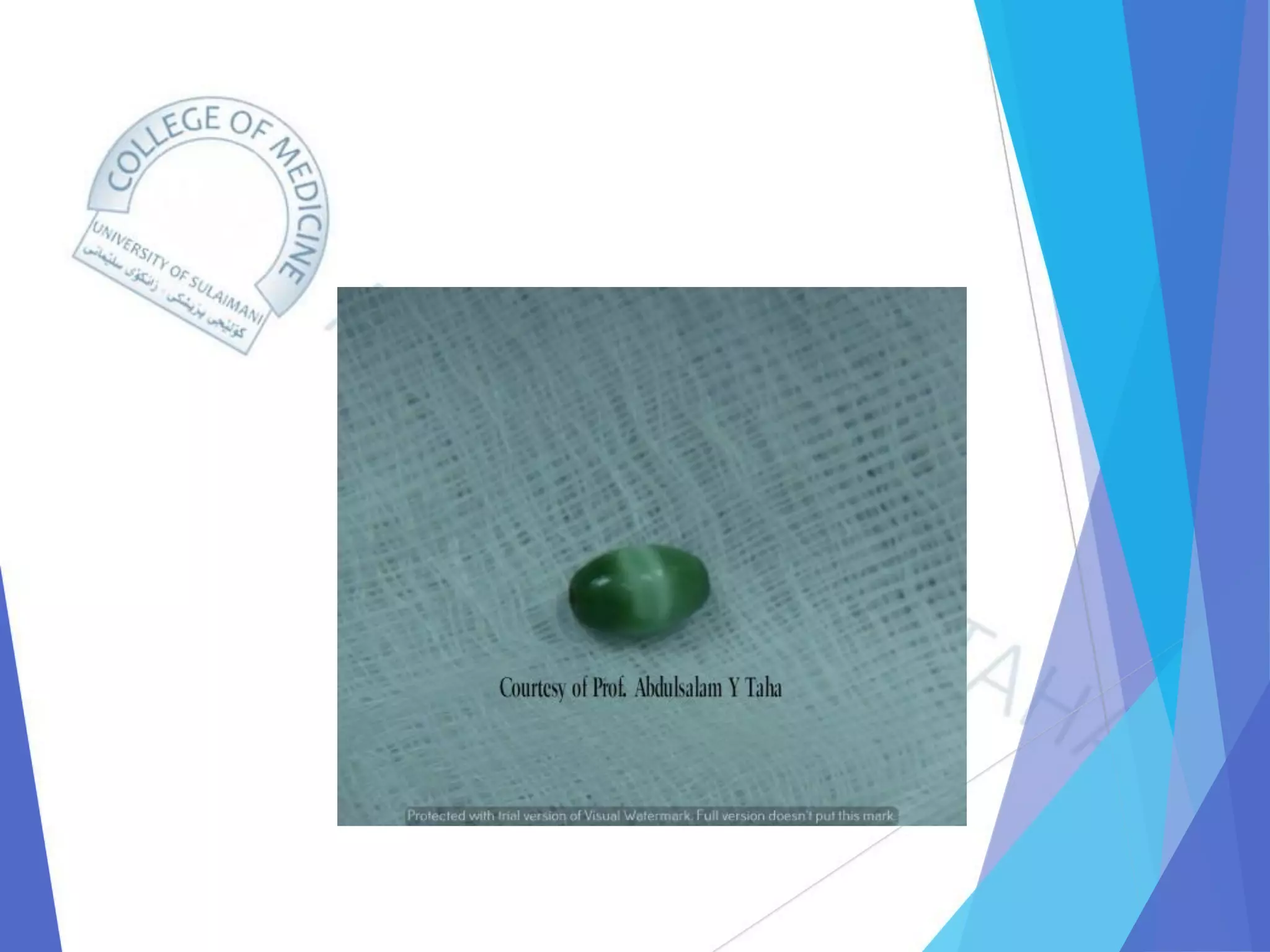 Bead in Right Main Stem Bronchus.pdf