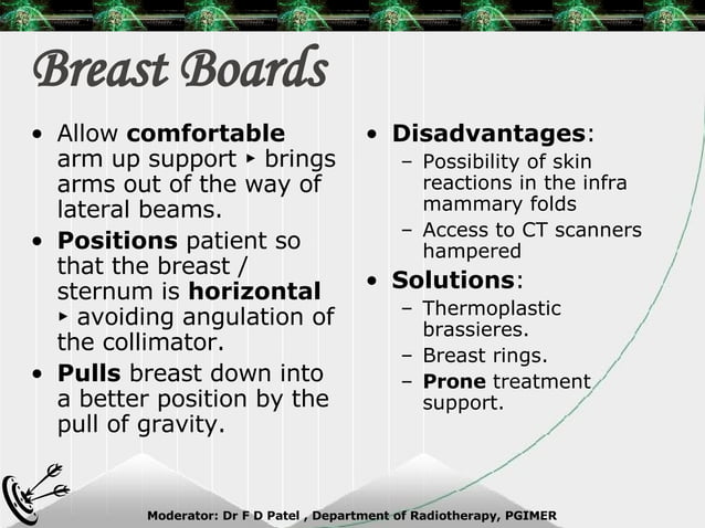 Beam Directed Radiotherapy - methods and principles | PPT