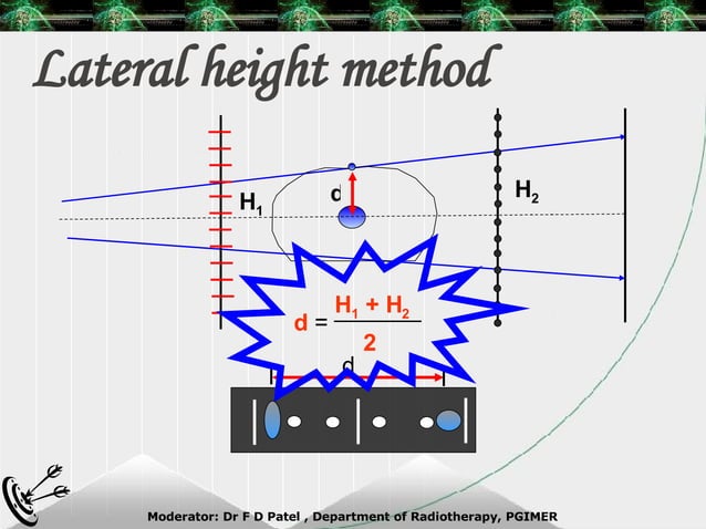 Beam Directed Radiotherapy - methods and principles | PPT