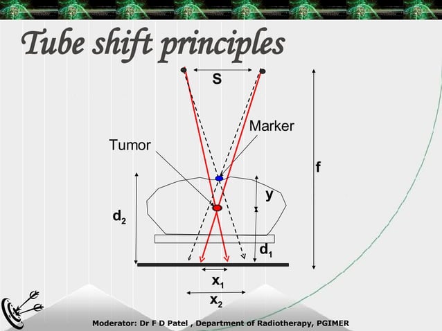Beam Directed Radiotherapy - methods and principles | PPT
