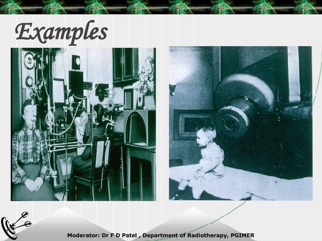 Beam Directed Radiotherapy - methods and principles | PPT