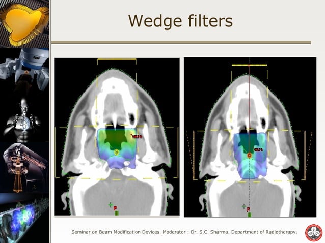 Beam Modification in Radiotherapy | PPT | Physics | Science