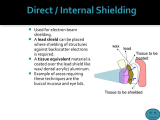 Beam modification-in-radiotherapy- | PPT