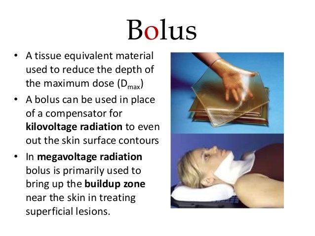 Beam modification in radiotherapy