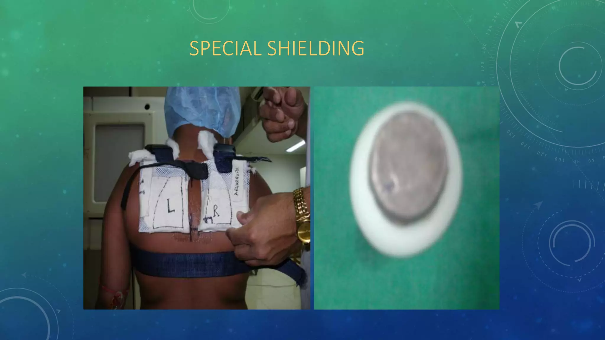 Beam modification devices | PPTX