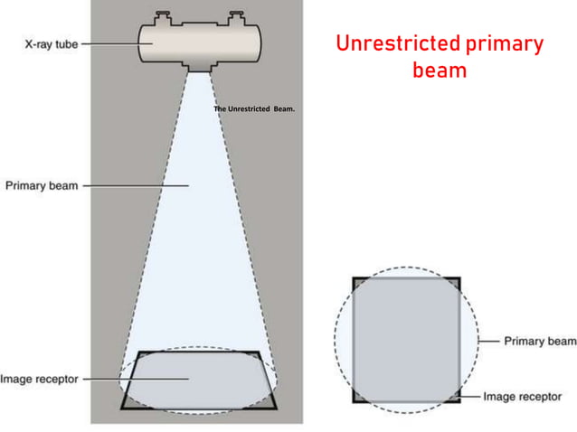 Beam restriction technique and devices.pptx
