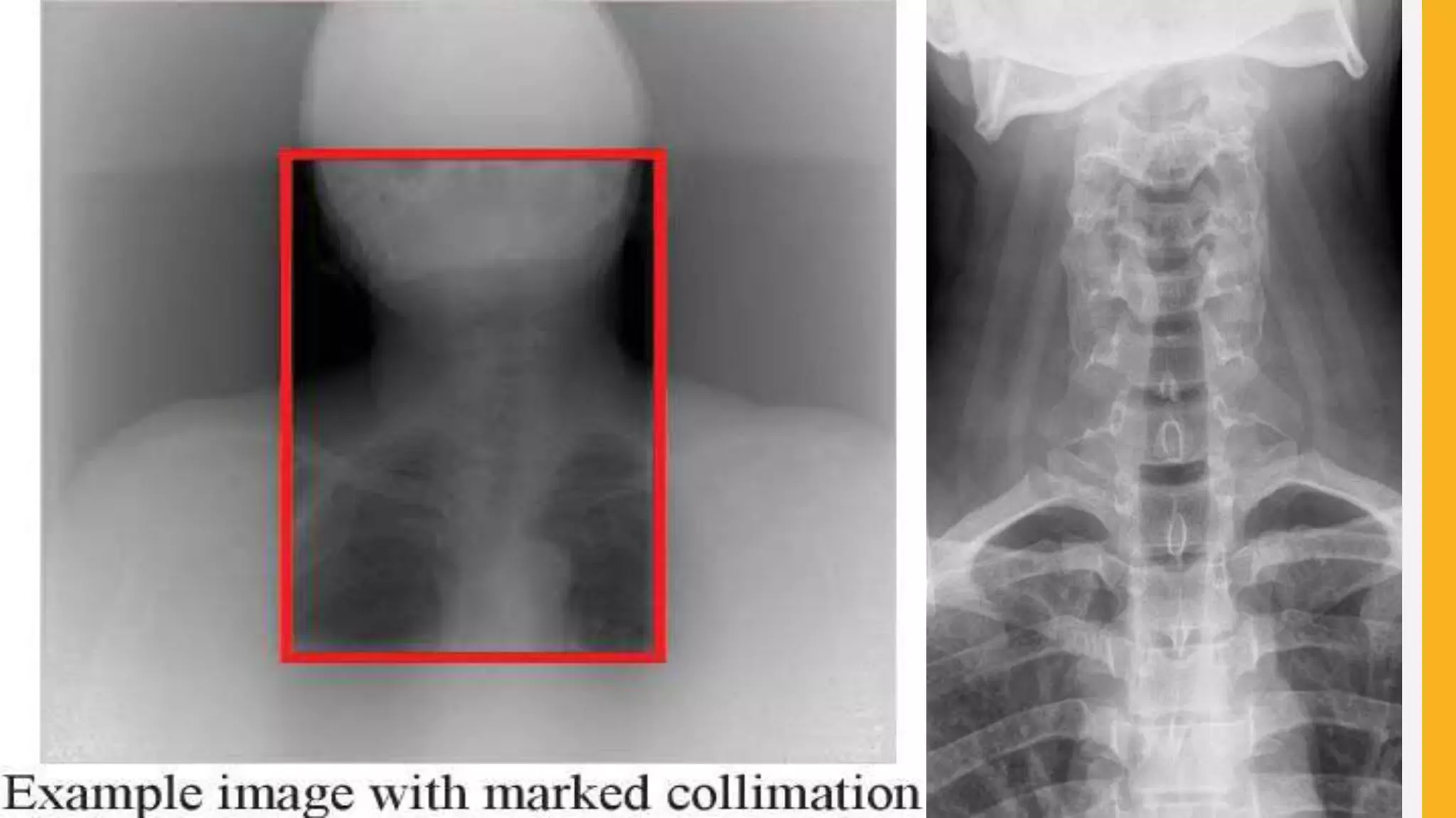 Beam Restrictor devices.pptx