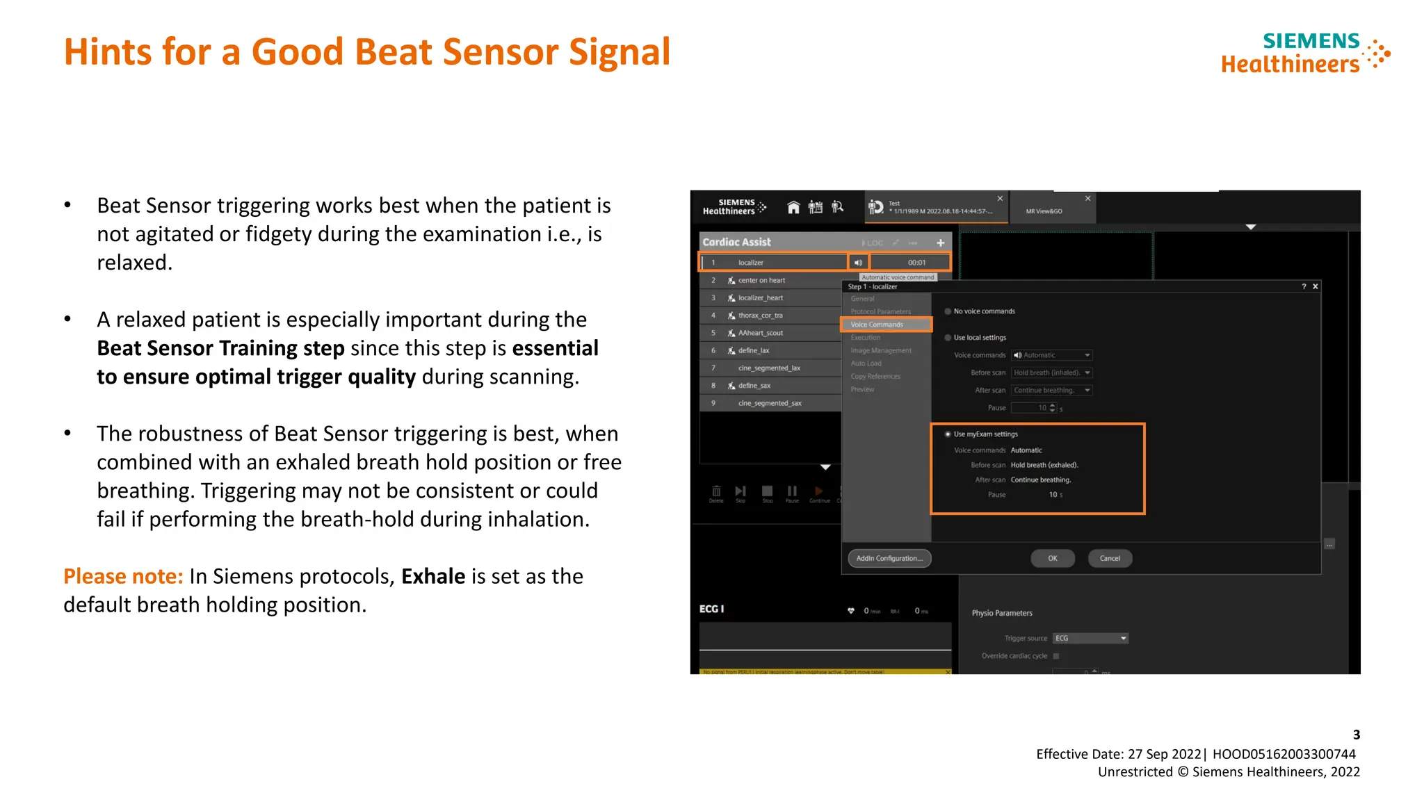 Beat sensor trouble shooting Biomatrix pdf | PDF