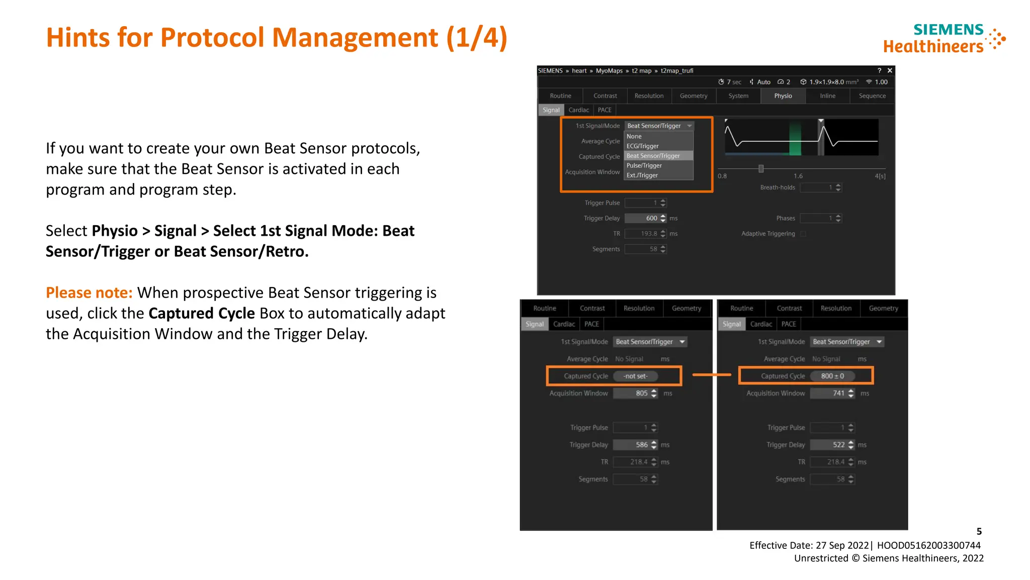 Beat sensor trouble shooting Biomatrix pdf | PDF