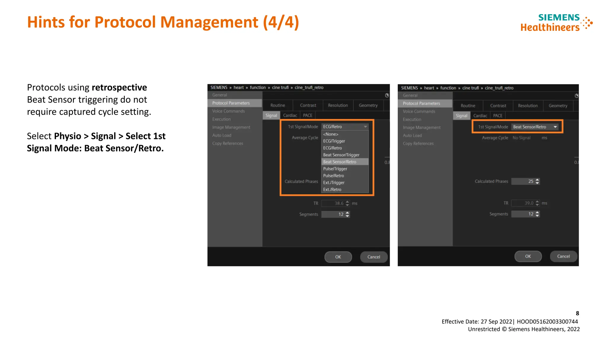 Beat sensor trouble shooting Biomatrix pdf | PDF