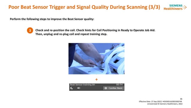 Beat sensor trouble shooting Biomatrix pdf | PDF | Medical Health