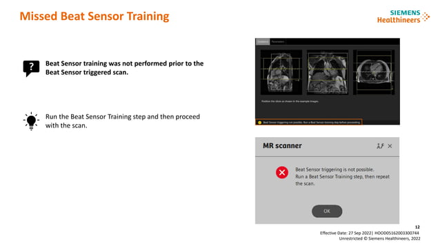 Beat sensor trouble shooting Biomatrix pdf | PDF | Medical Health