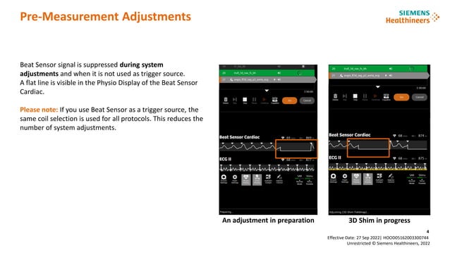 Beat sensor trouble shooting Biomatrix pdf | PDF | Medical Health