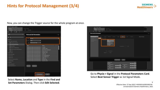 Beat sensor trouble shooting Biomatrix pdf | PDF | Medical Health