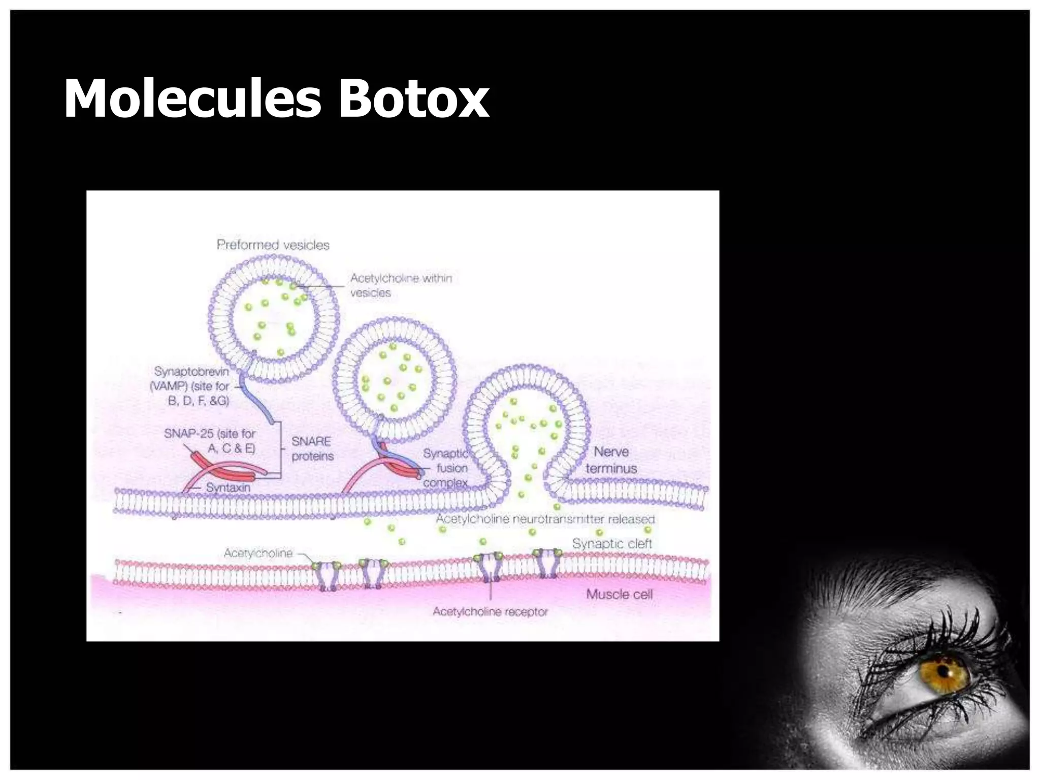 The Beauty of BOTOX | PPTX