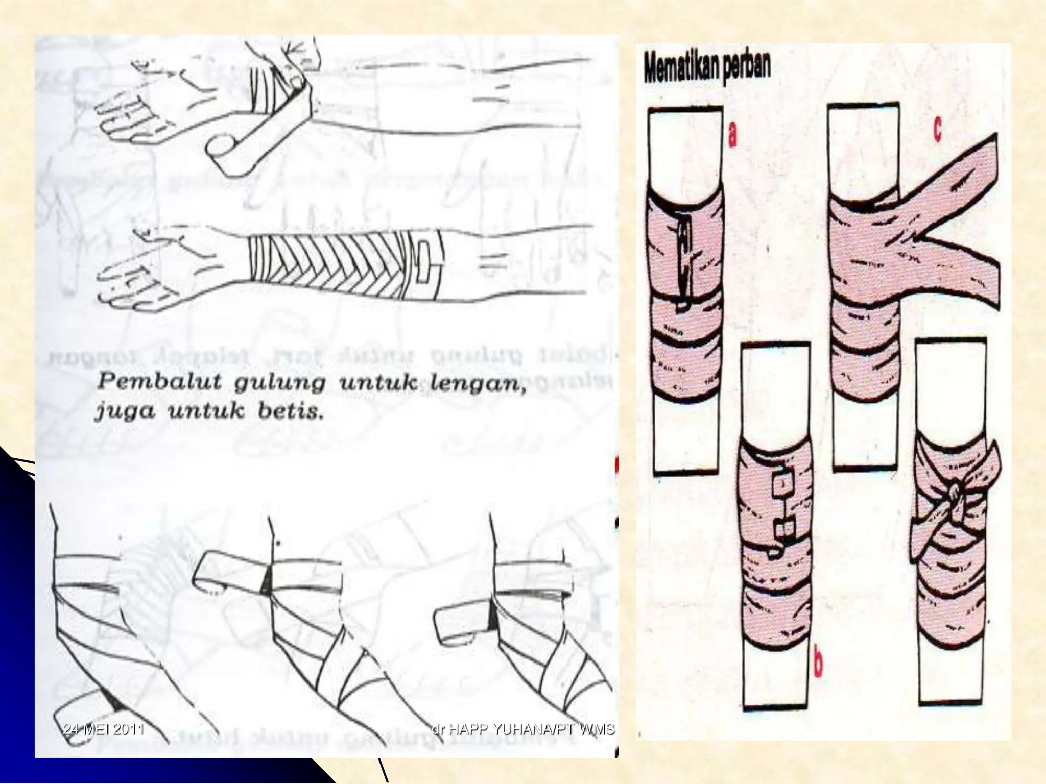 BEBAT BIDAI untuk pertolongan pertama .ppt
