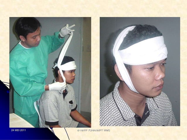 BEBAT BIDAI untuk pertolongan pertama .ppt