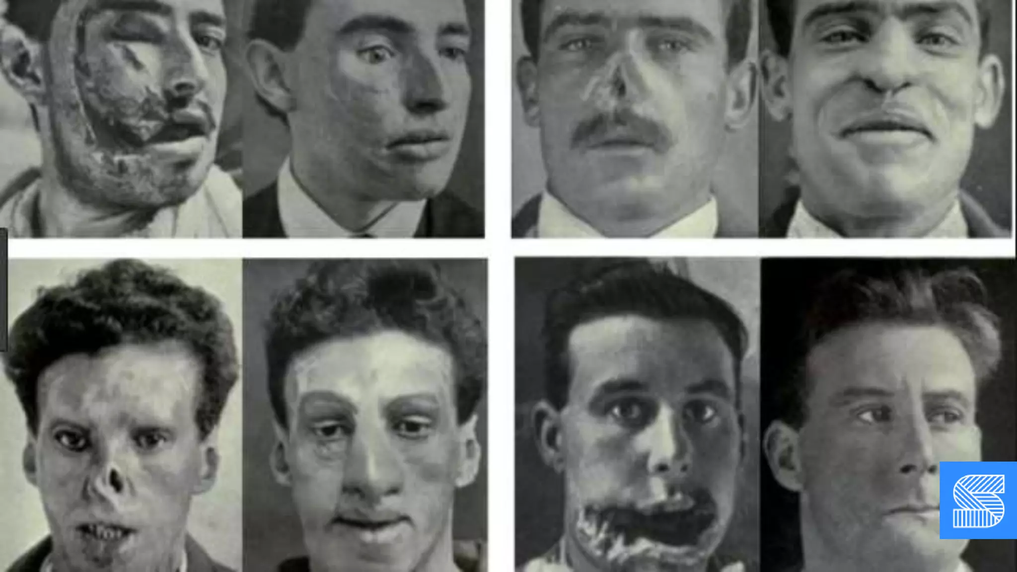 Be brave own your scars | PPT