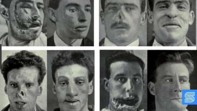 Be brave own your scars | PPT