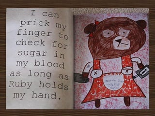 Because of Ruby | PDF