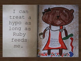 Because of Ruby | PDF