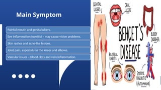 Bechet's Syndrome symptoms and its medicine.pptx