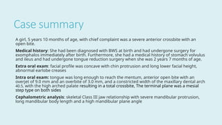 Beckwith-Wiedemann syndrome.pptx a case study | PPTX