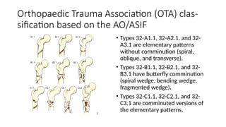 Fracture of femoral shaft and subtrochanteric | PPTX