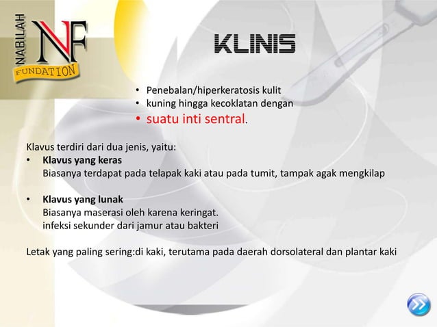 Bedah minor ; eksisi clavus | PPTX