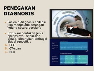 Bedah saraf kejang epilepsi | PPTX