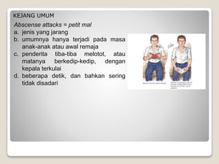 Bedah saraf kejang epilepsi | PPTX