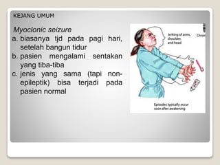 Bedah saraf kejang epilepsi | PPTX