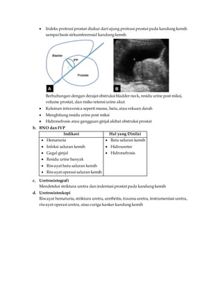 Rangkuman Materi Urologi | DOCX