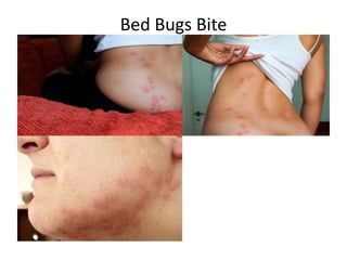 Bed bugs awareness | PPTX