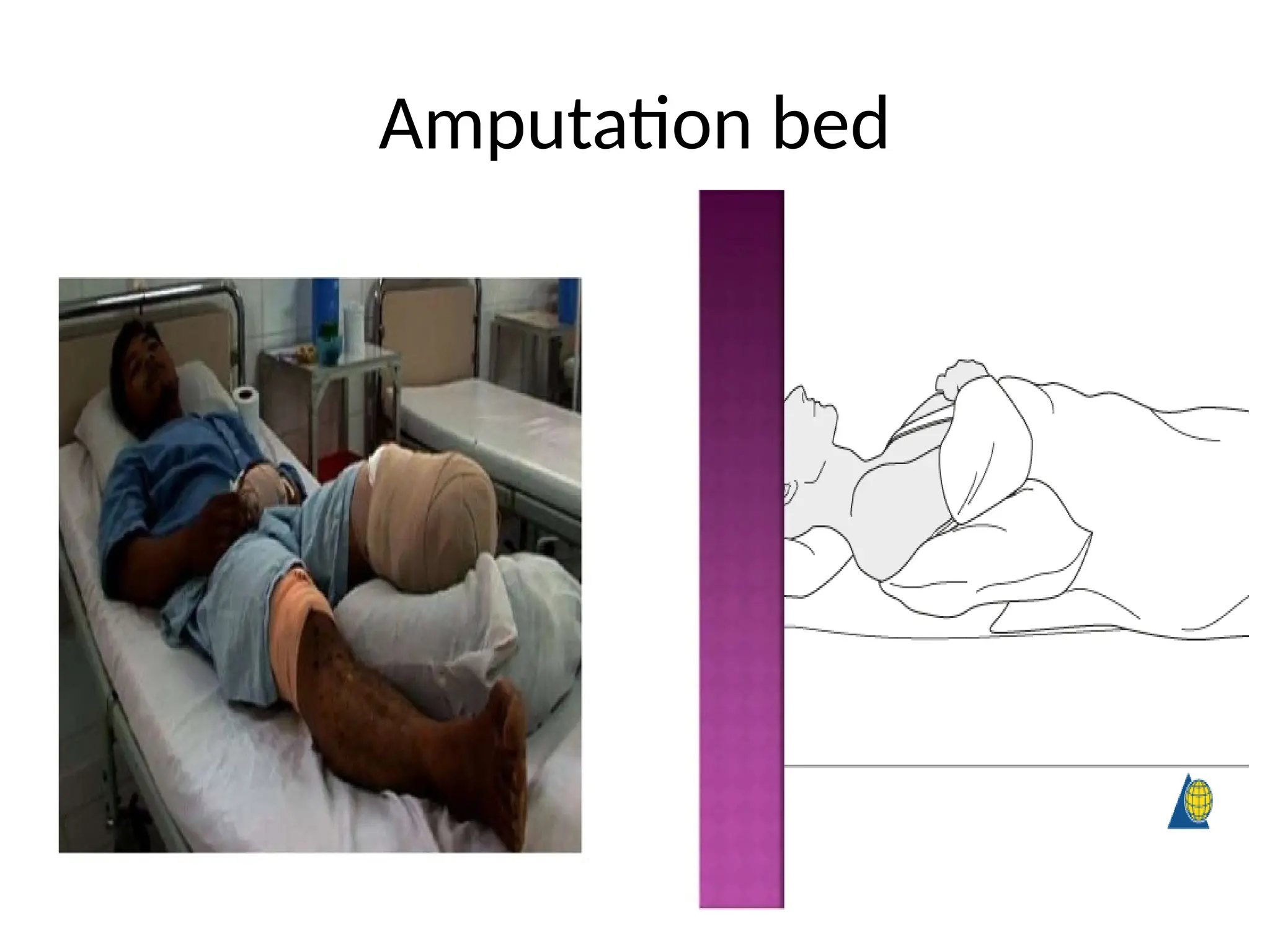 hOSPITAL BED MAKING PROCEDURE GUIDELINE | PPTX