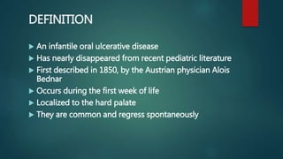Bednar’s aphthae | PPTX