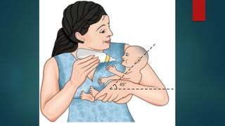 Bednar’s aphthae | PPTX