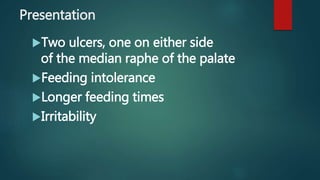 Bednar’s aphthae | PPT