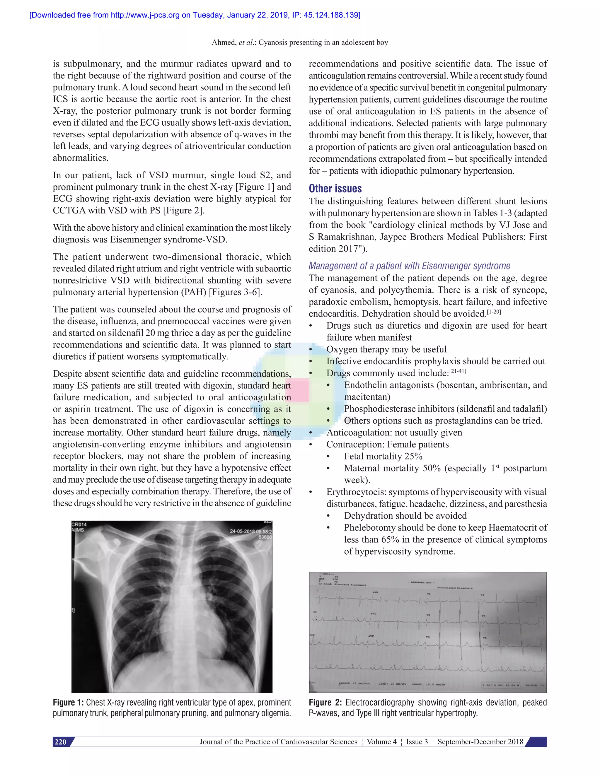 Bedside case discussion aiims cardiology | PDF